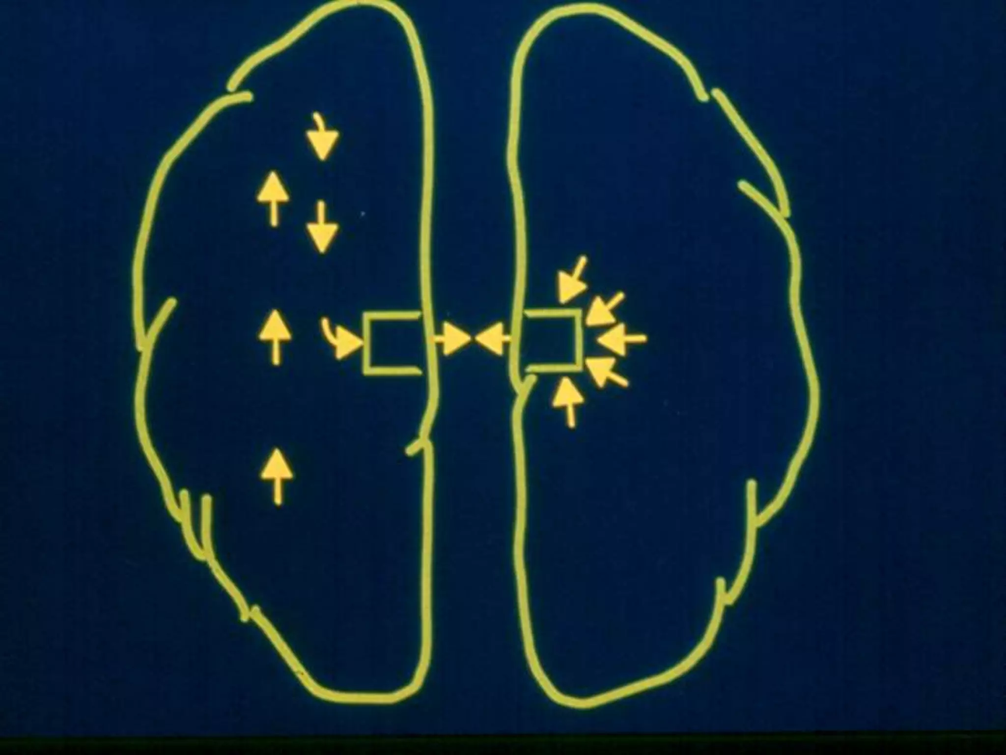 The 4MAT system | PPT