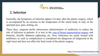 The 7 most common plastic surgery complications | PPT