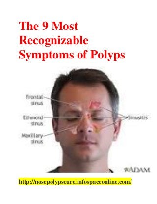 The 9 most recognizable symptoms of polyps