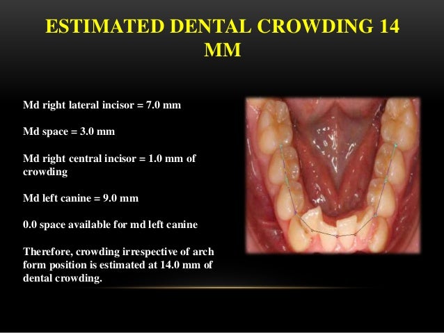 The abo discrepancy index (di)