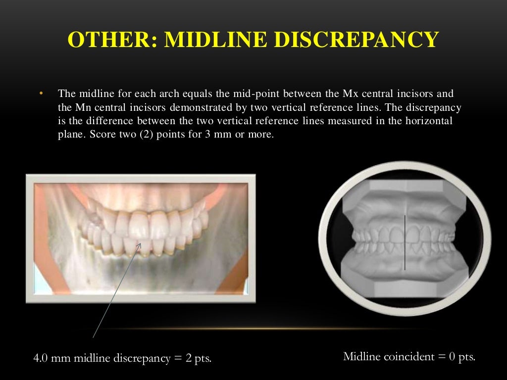 The abo discrepancy index (di)
