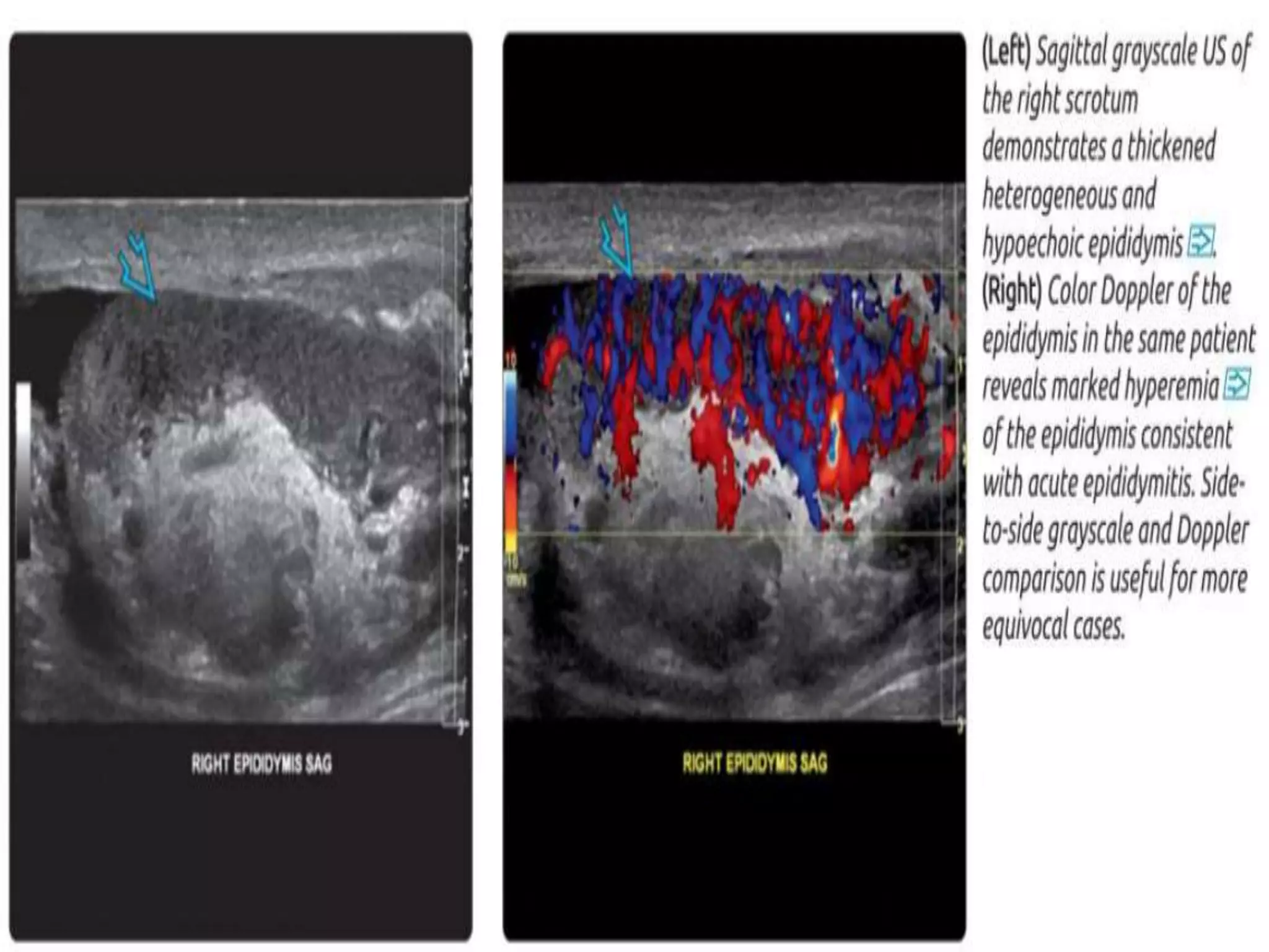 The Acute Scrotum.pptx