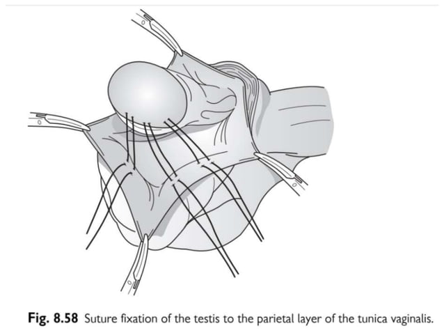 The Acute Scrotum.pptx