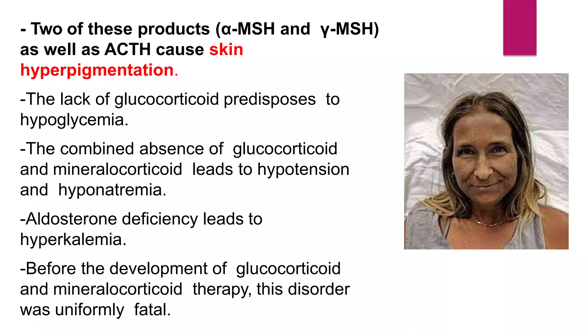The Adrenal Gland-converted.pptx