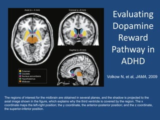 The adult ADHD tool kit for everday life handling strategies | PDF
