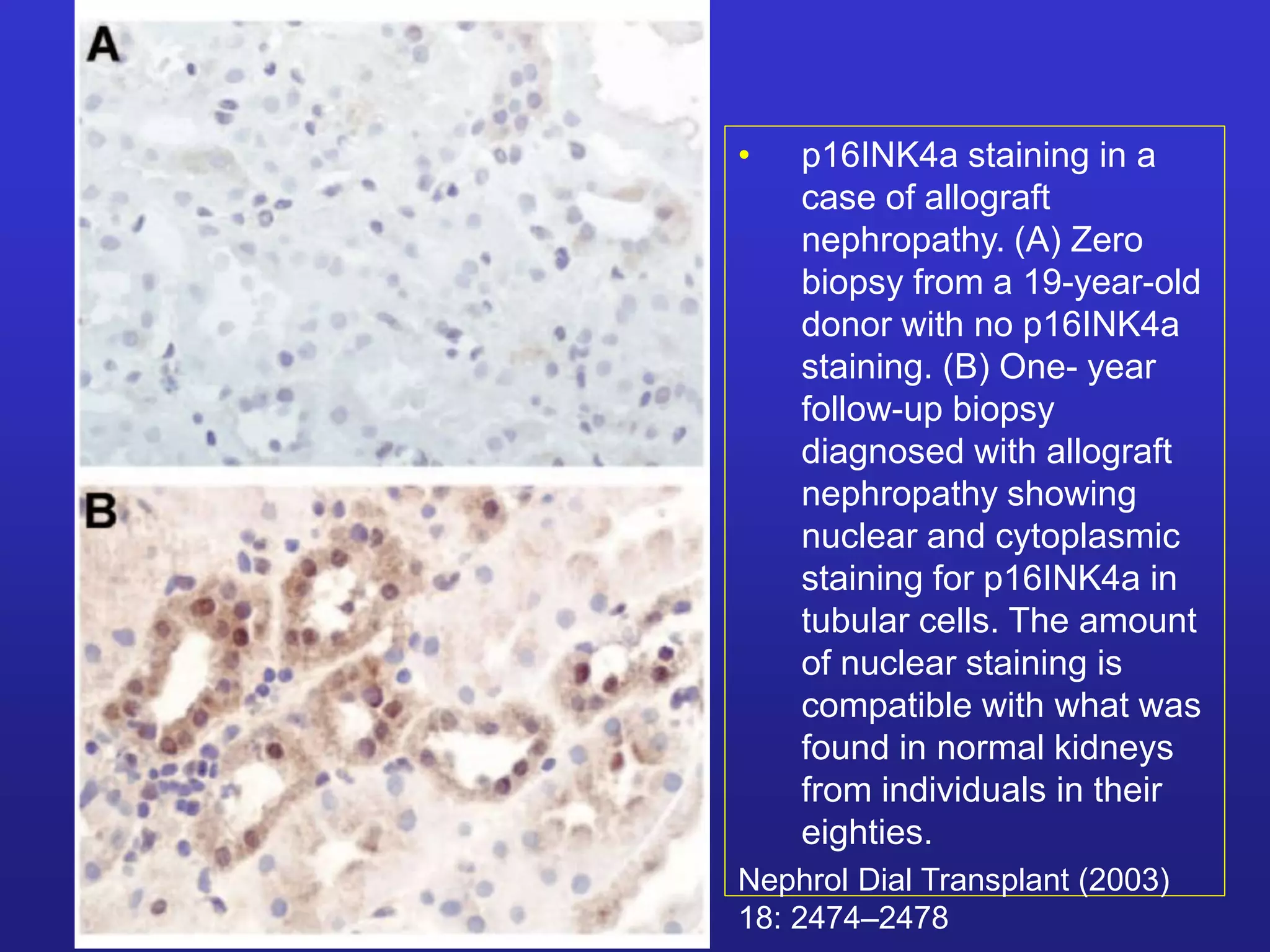 The aging kidneys | PPTX