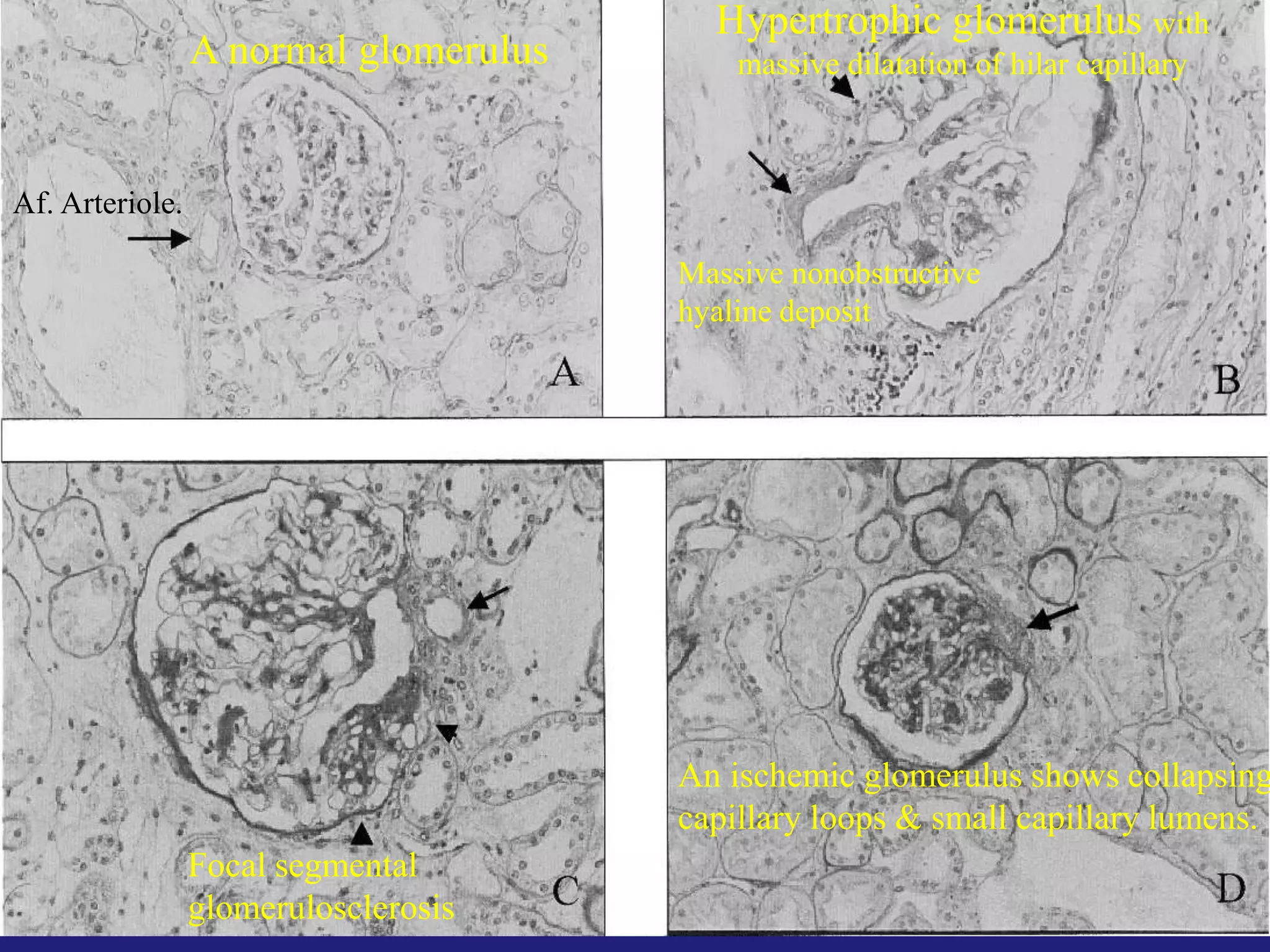 The aging kidneys | PPTX