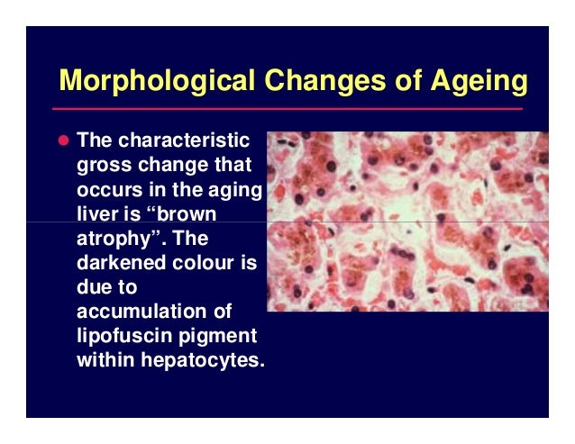 The aging liver