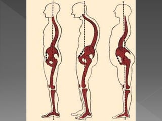 The alexander technique | PPTX