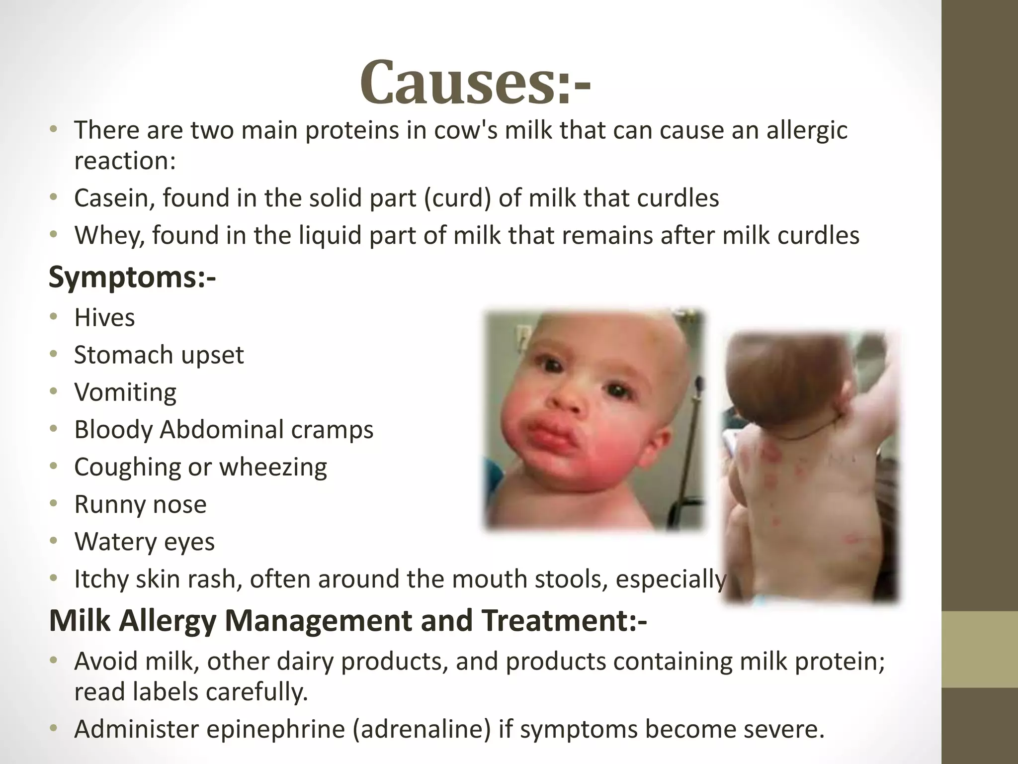 The allergic reaction process | PPT