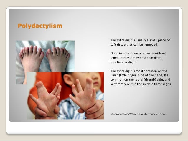 Cultural Diversity - Health Care & The Amish