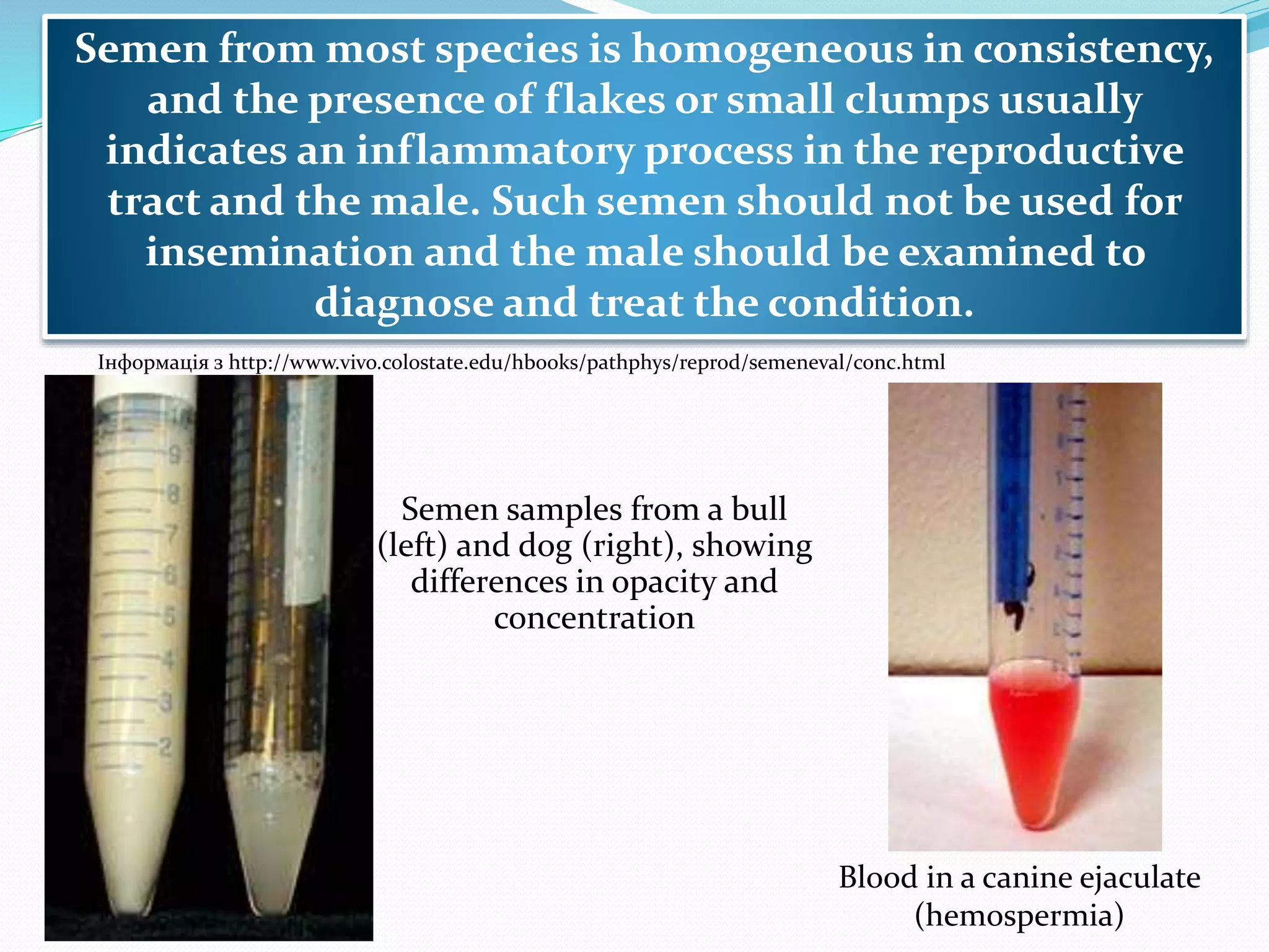 Sperm count.pptx | Infertility | Reproductive Health