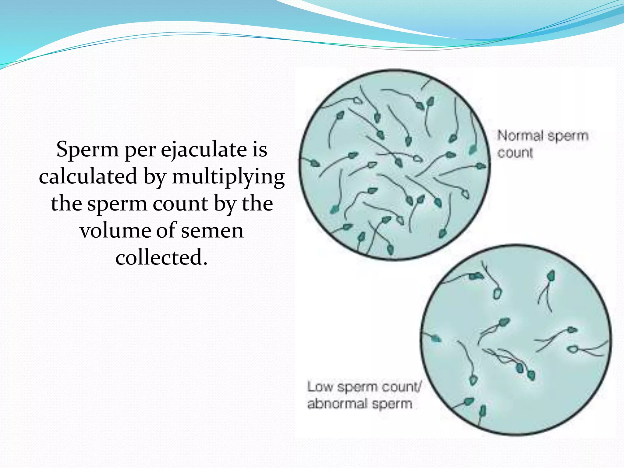Sperm count.pptx | Infertility | Reproductive Health