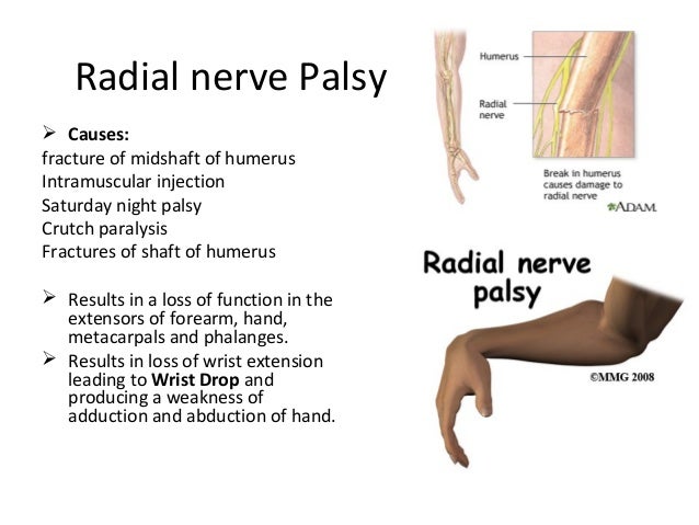 The anatomy of the arm