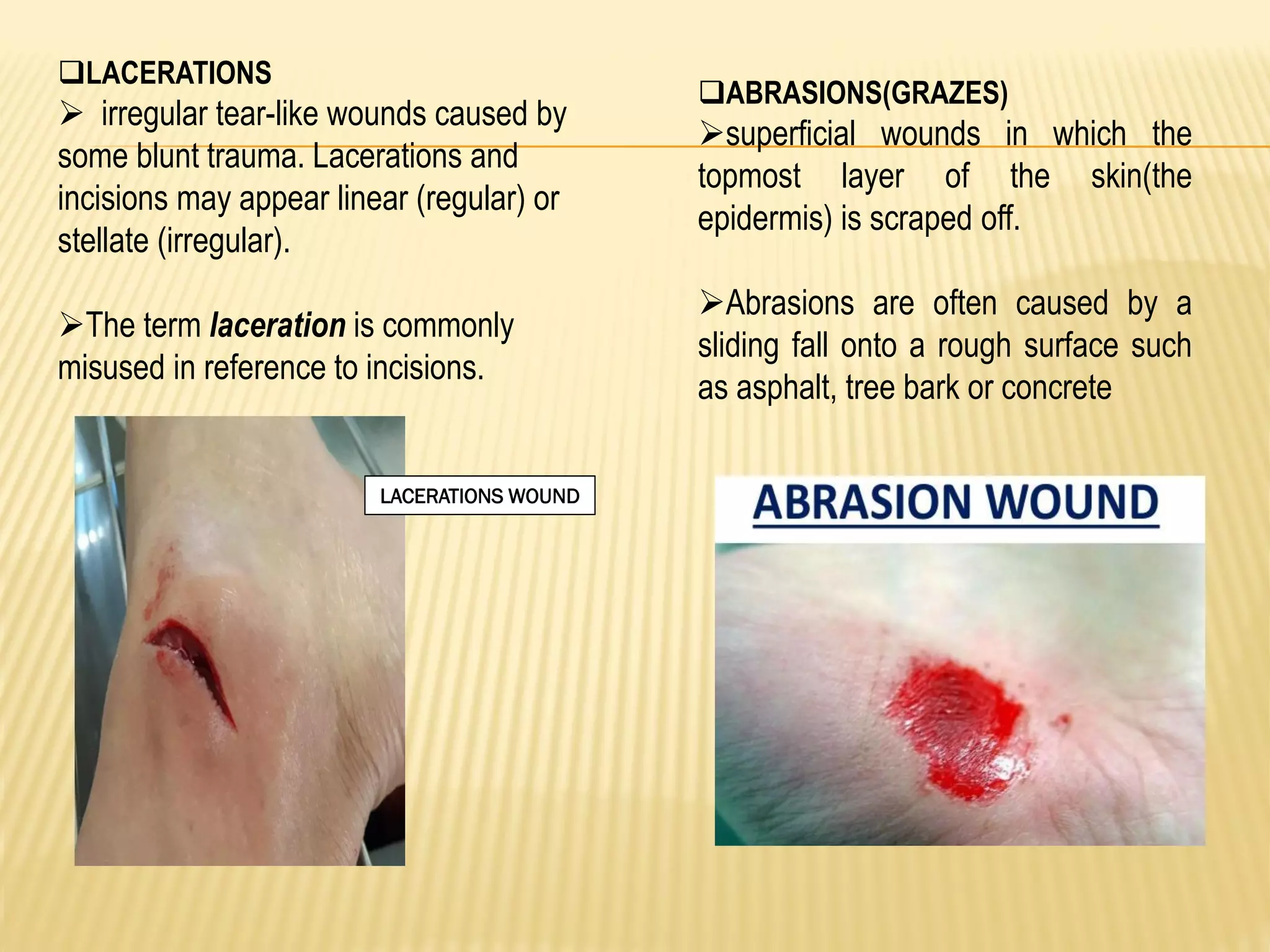 THE ANIMAL BITES AND WOUNDS | PDF