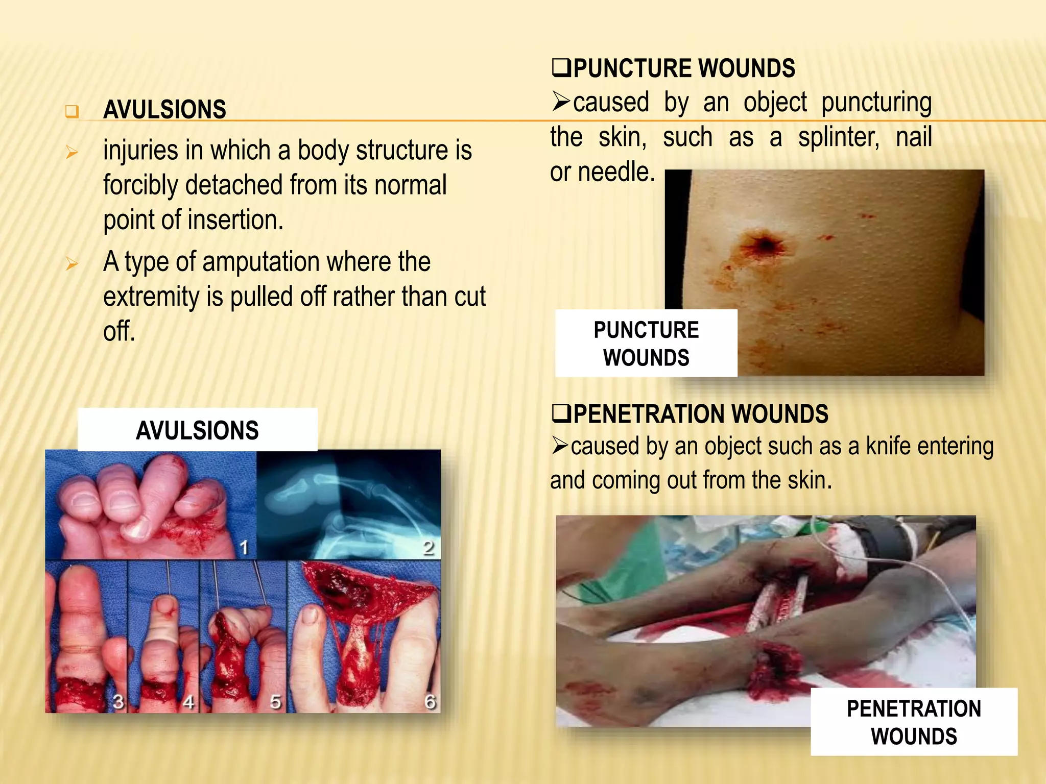 THE ANIMAL BITES AND WOUNDS | PDF