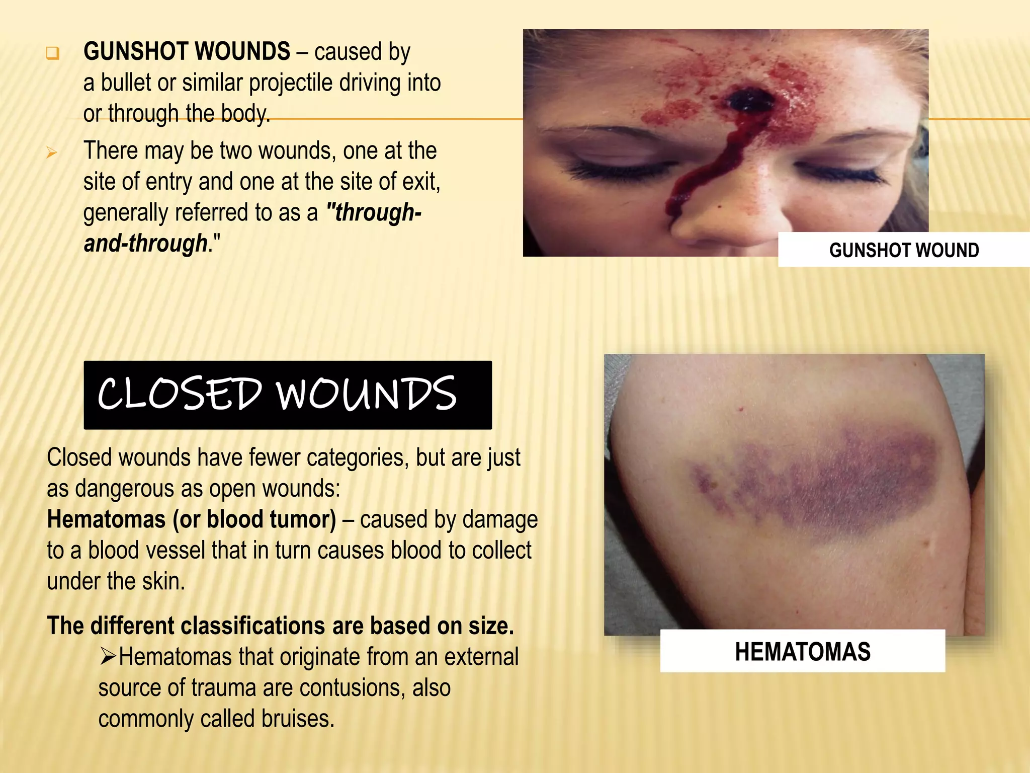 THE ANIMAL BITES AND WOUNDS | PDF