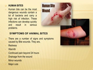 THE ANIMAL BITES AND WOUNDS | PDF