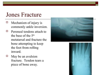 the ankle and foot anatomy presentation for education | PPT