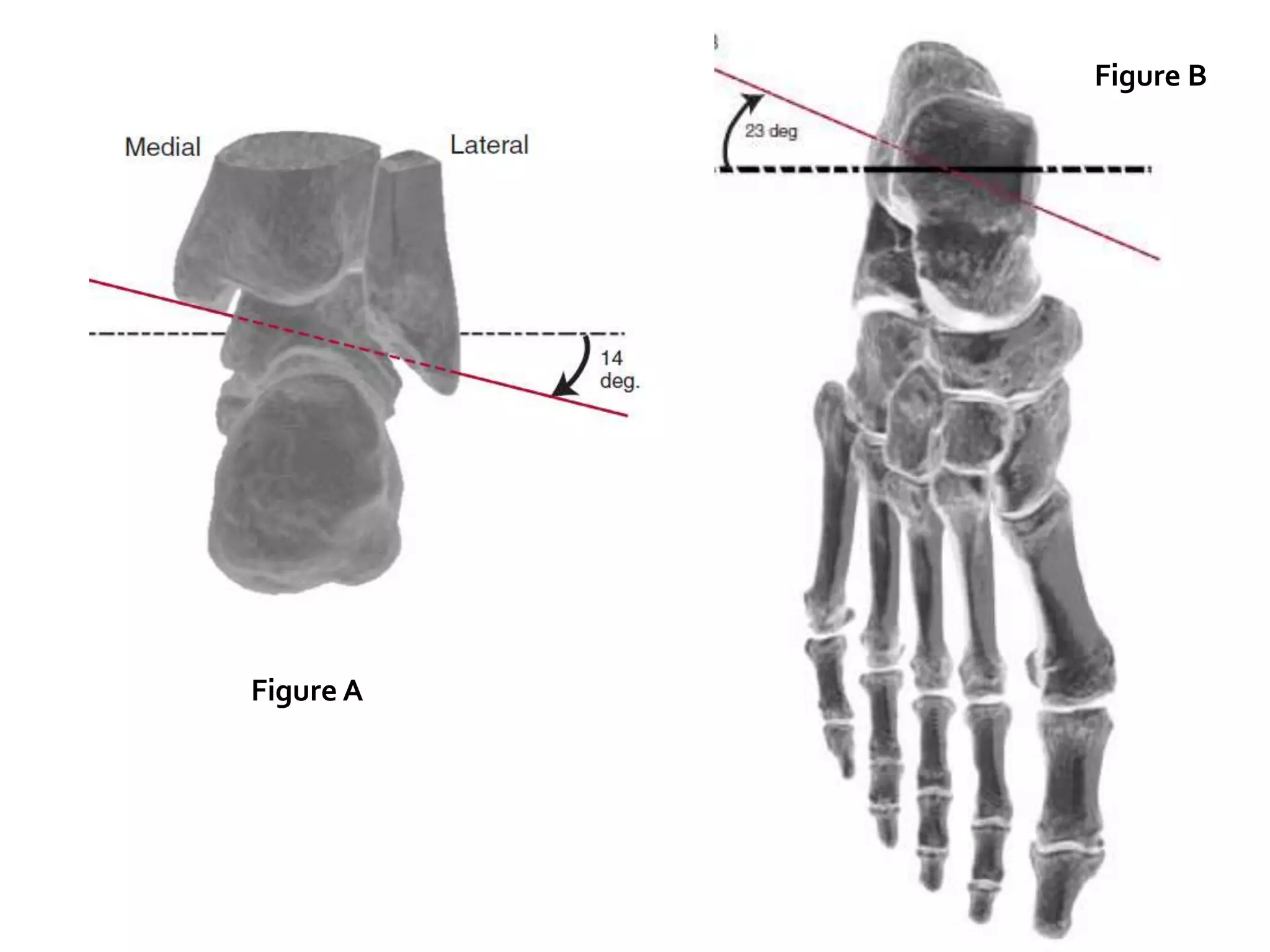 The ankle and foot complex | PPTX