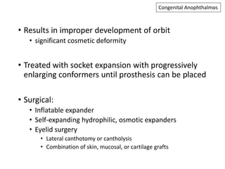 The Anophthalmic socket | PPTX