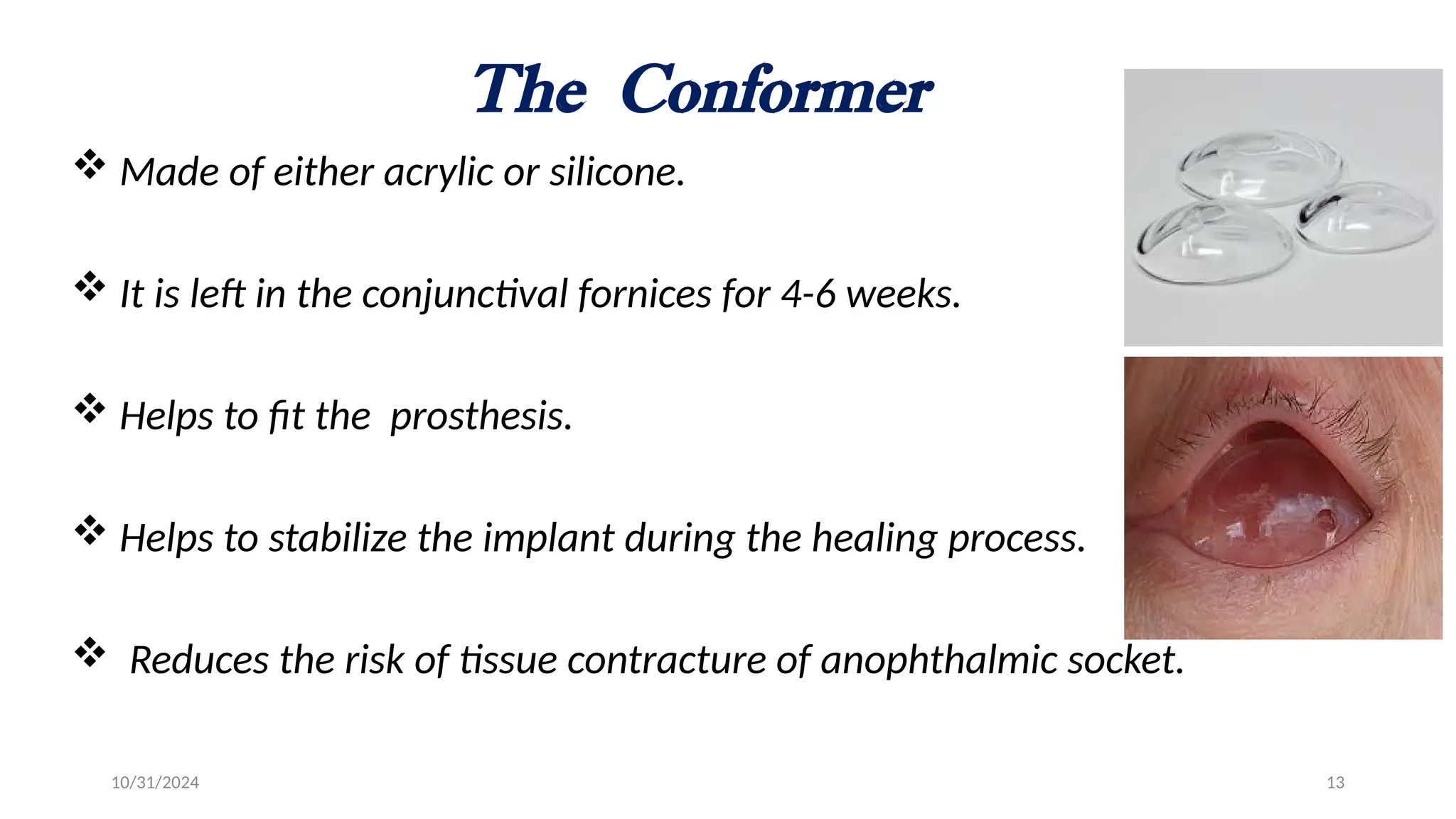 The Anophthalmic Socket .Dr.Asrat Tadesse | PPTX