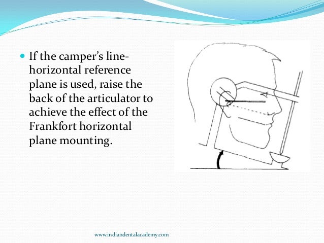 The anterior point of reference /certified fixed orthodontic courses…