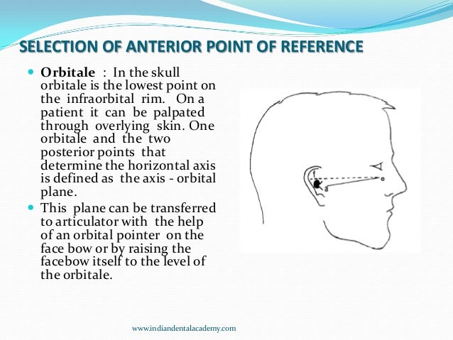 The anterior point of reference /certified fixed orthodontic courses…