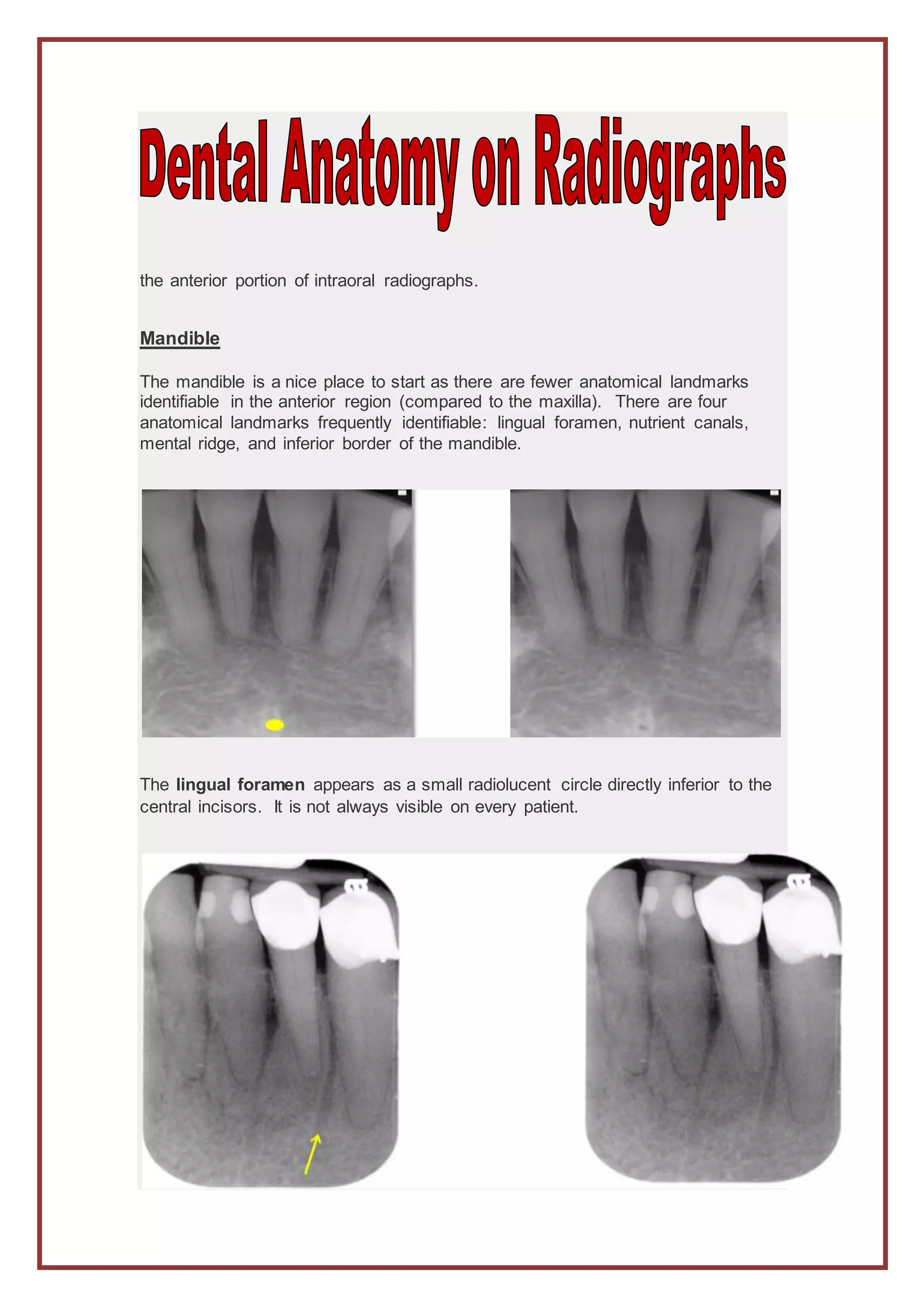 The anterior portion of intraoral radiographs | DOCX