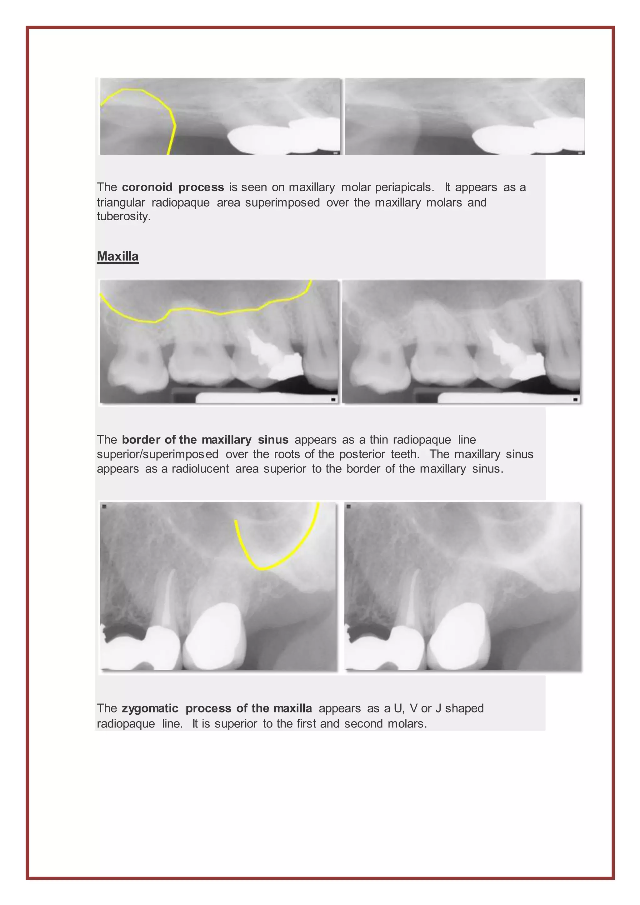 The anterior portion of intraoral radiographs | DOCX