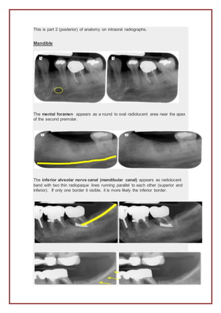 The anterior portion of intraoral radiographs | DOCX