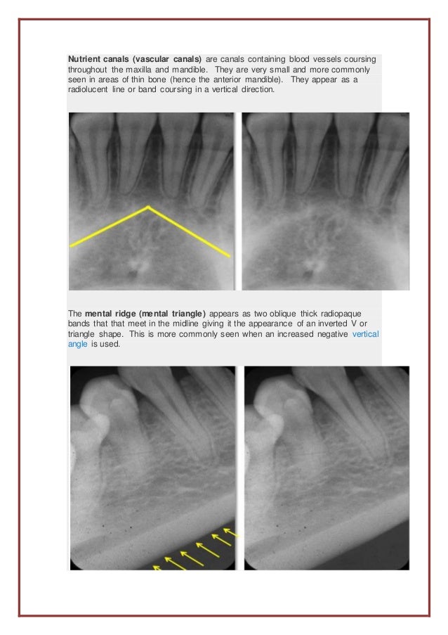 Nutrient Canal Radiograph ADAE International... ADAE International