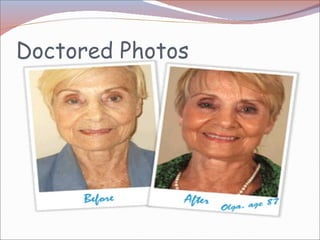 Anti Aging Technology | PPT