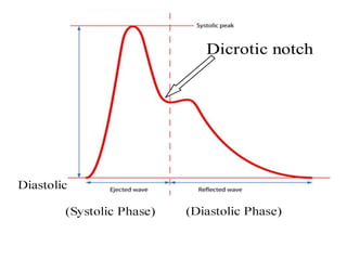 Carotid Pulse Tracing