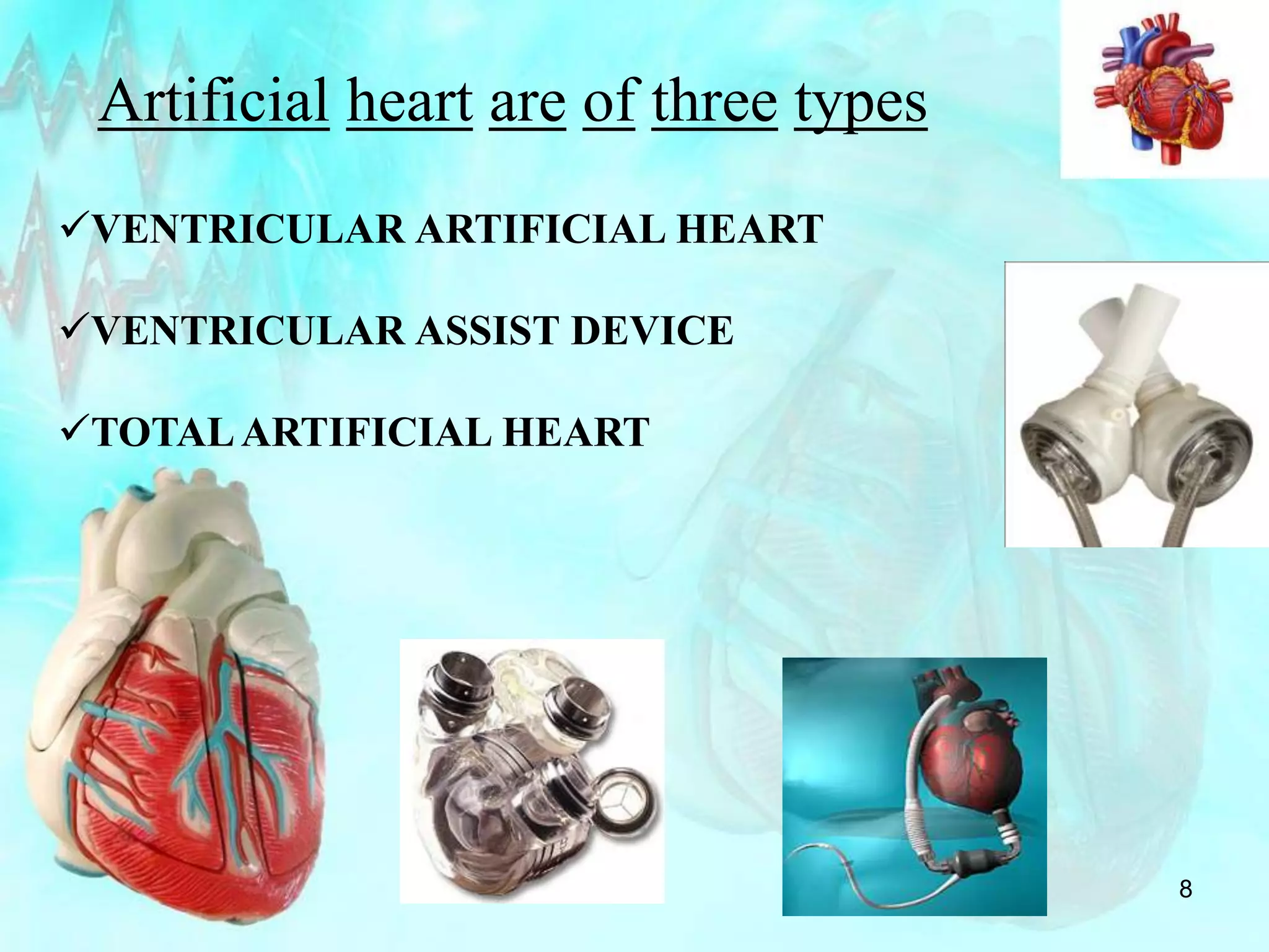 The artificial heart | PPTX