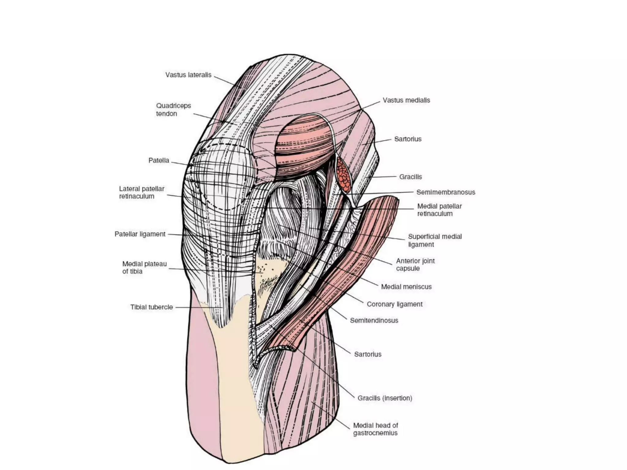 The art of medial release in varus knee during total knee replacement ...