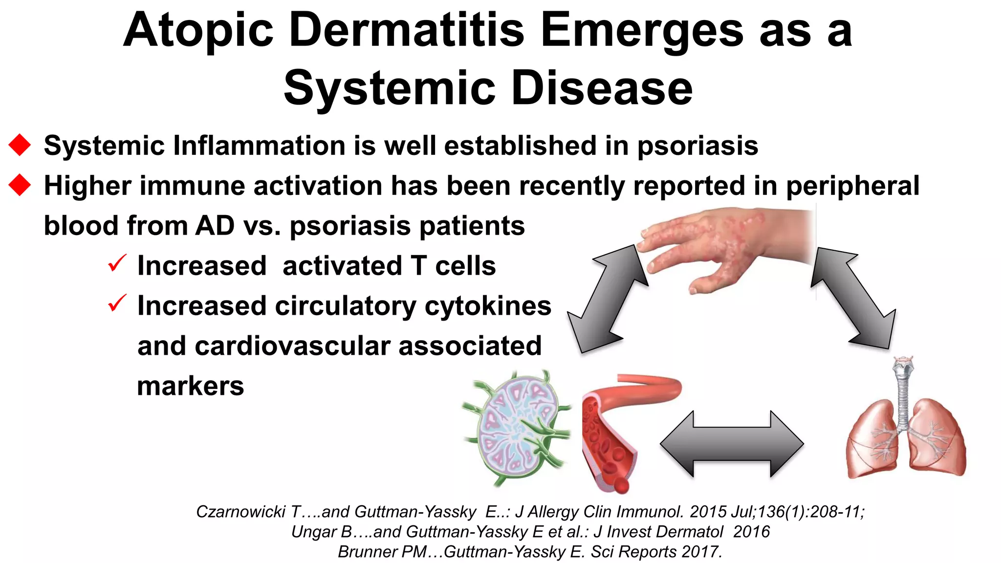 The atopic dermatitis pathogenesis and implications for alopecia areata ...