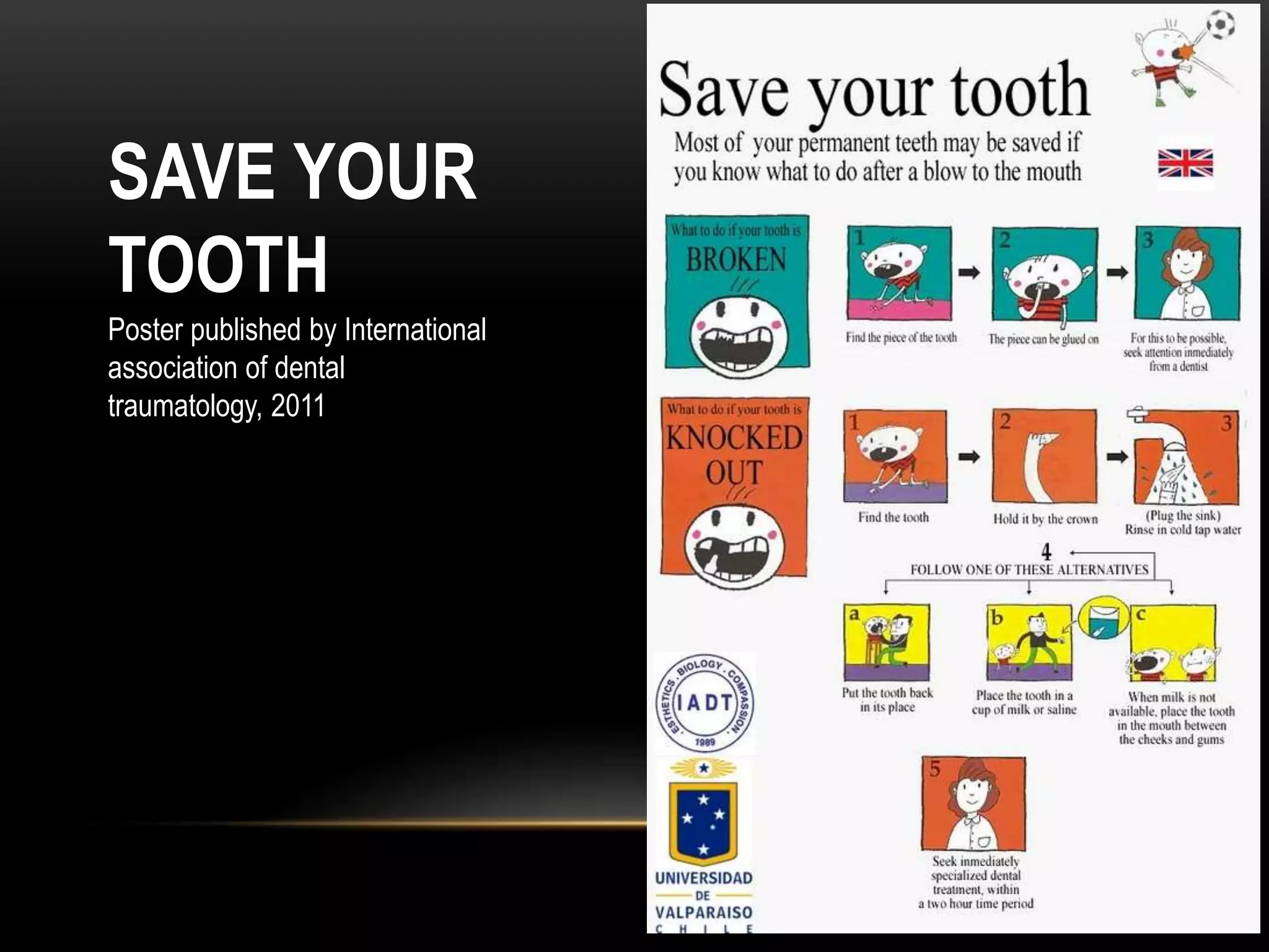 The avulsed tooth | PPTX