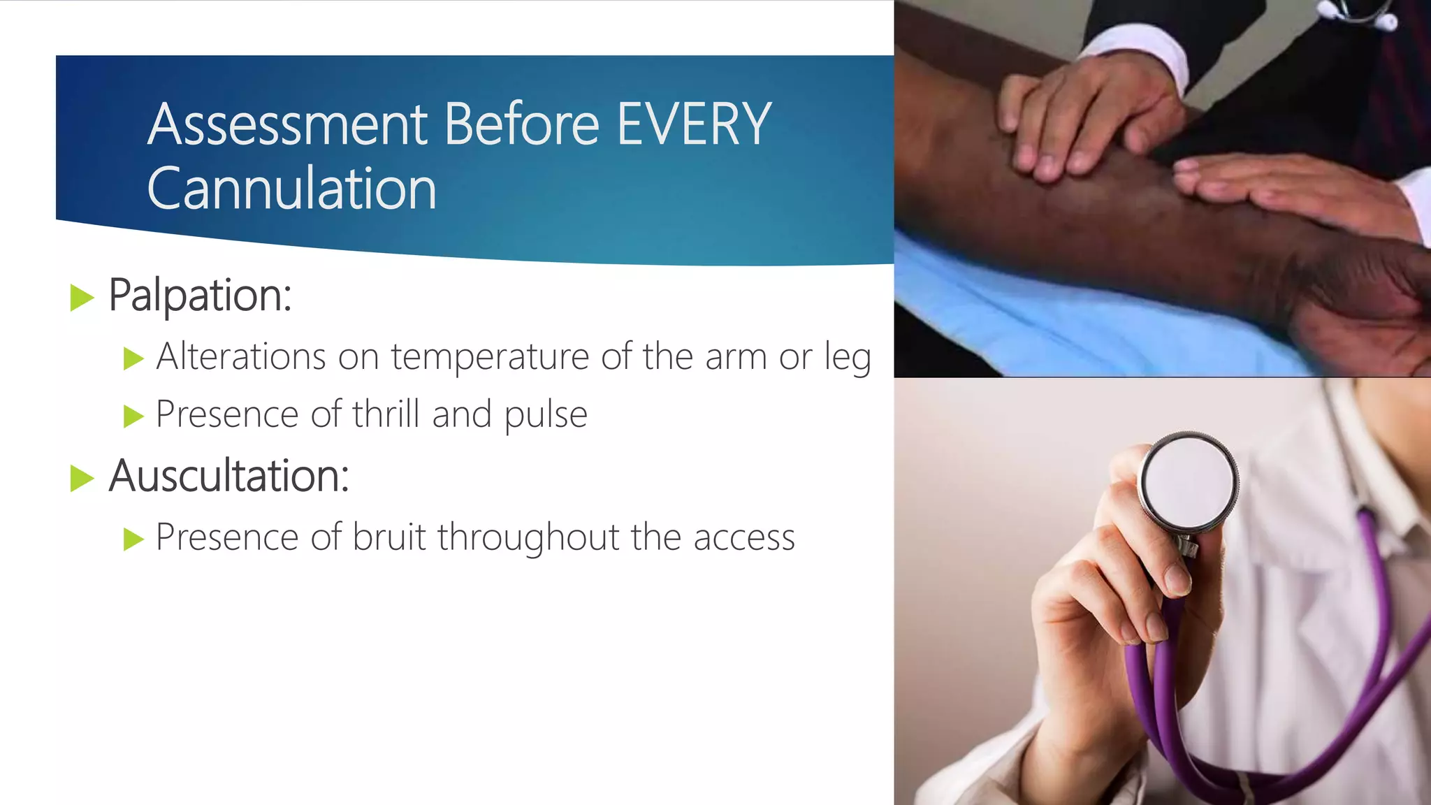 AV Vascular Access - Hemodialysis | PPTX