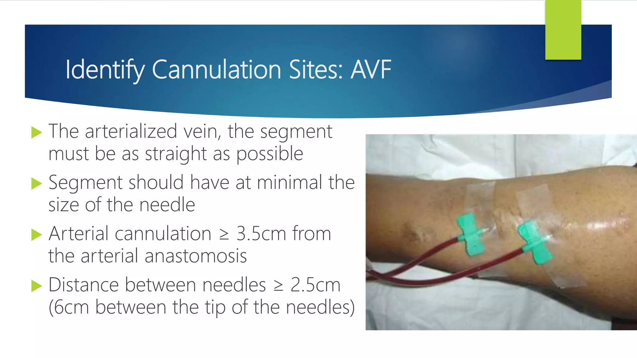 AV Vascular Access - Hemodialysis | PPTX