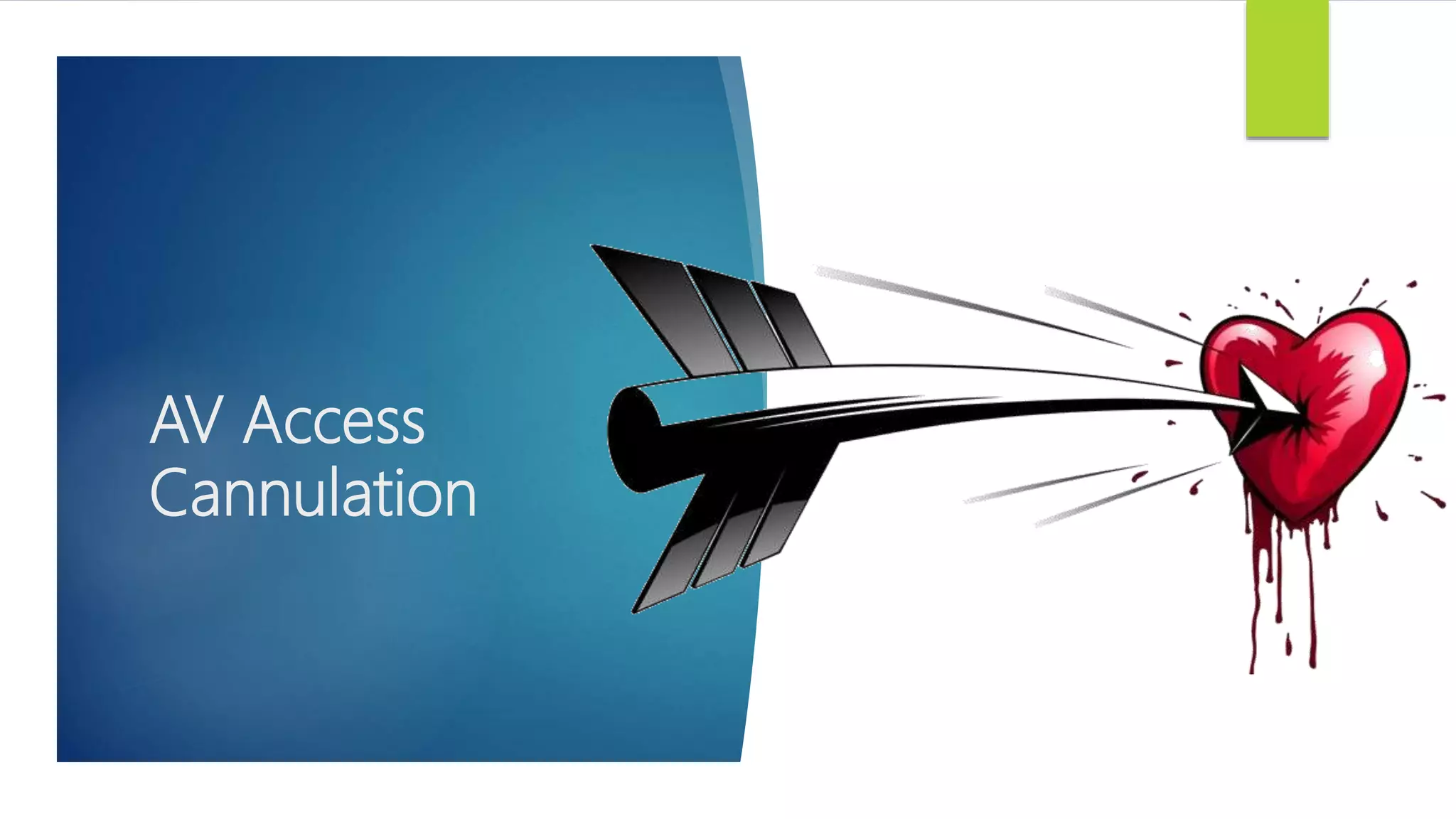 AV Vascular Access - Hemodialysis | PPTX