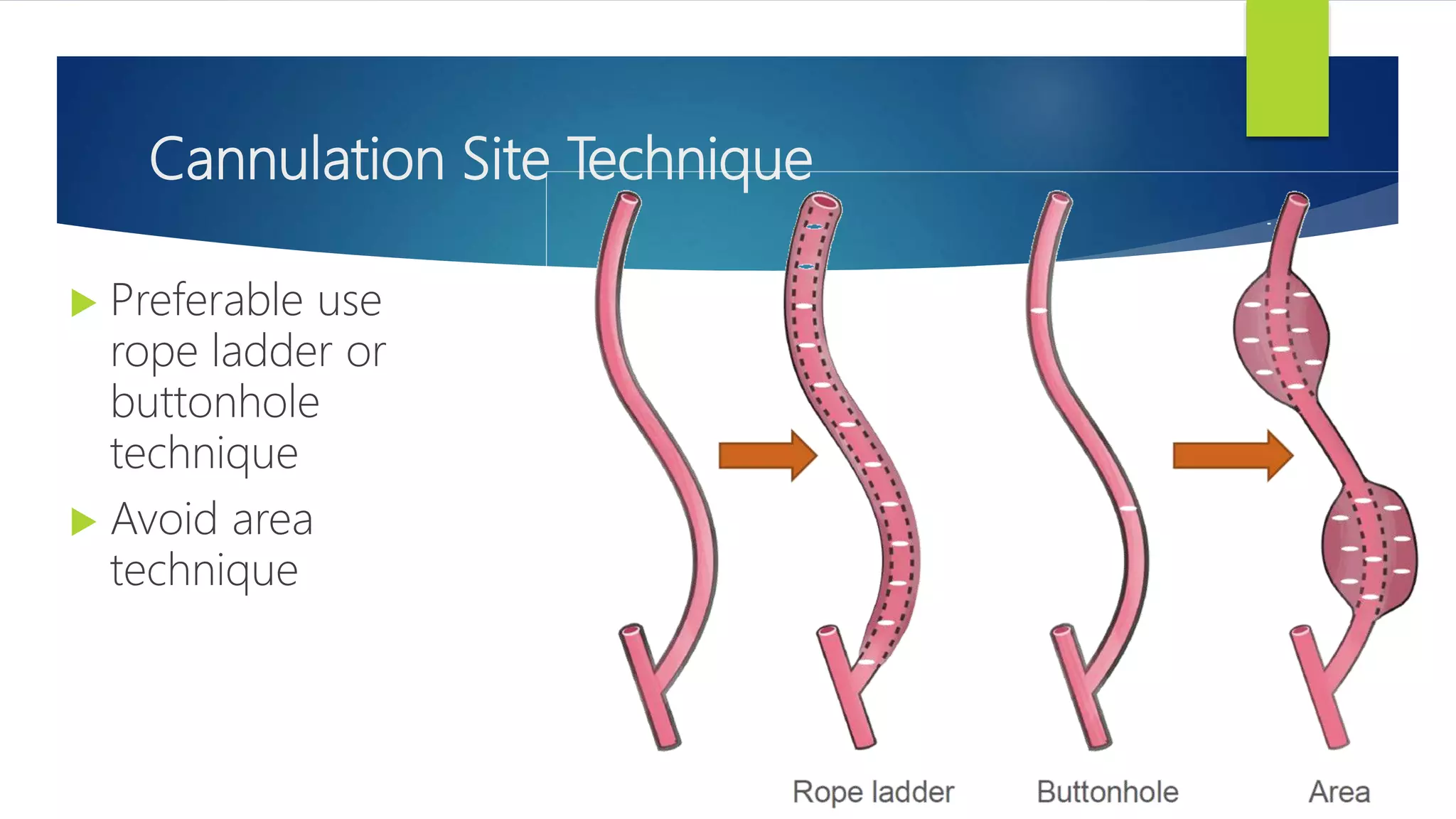 AV Vascular Access - Hemodialysis | PPTX