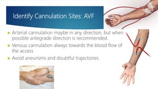 AV Vascular Access - Hemodialysis | PPTX