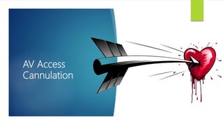 AV Vascular Access - Hemodialysis | PPTX