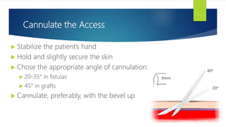 AV Vascular Access - Hemodialysis | PPTX