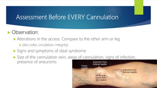 AV Vascular Access - Hemodialysis | PPTX