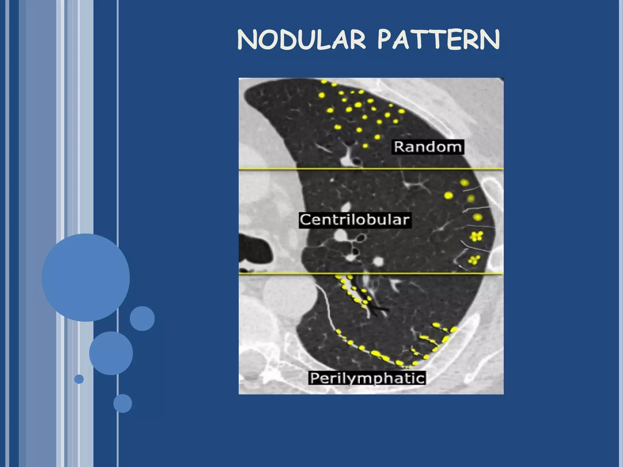 The basic interpretation of hrct | PPT