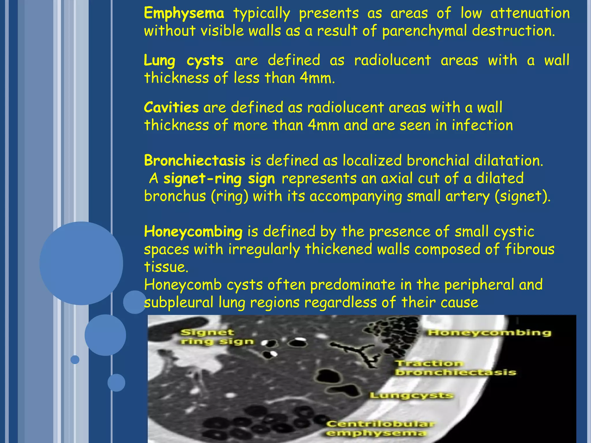 The basic interpretation of hrct | PPT