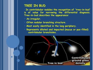 The basic interpretation of hrct | PPT