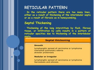 The basic interpretation of hrct | PPT